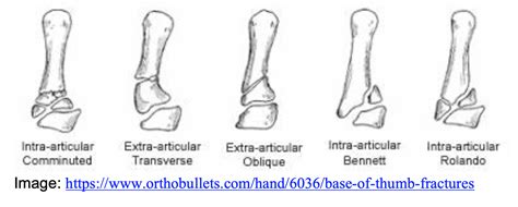 EmDOCs Net Emergency Medicine EducationEM AM Metacarpal Base Fractures EmDOCs Net