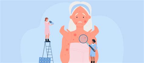 Gabapentin For Shingles Dosage Treatment Side Effects Internationaldrugmart