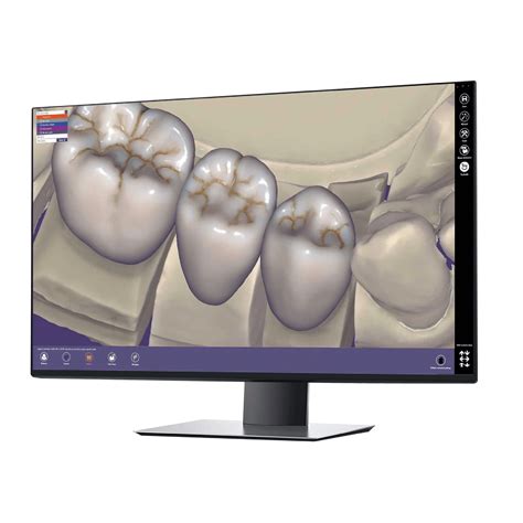 Exocad Software Ultimate Package FREE Training Evolve Dentistry