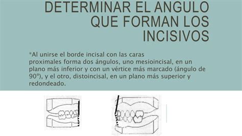 Metodologia Del Analisisydiagnosticodelaoclusionenestaticay