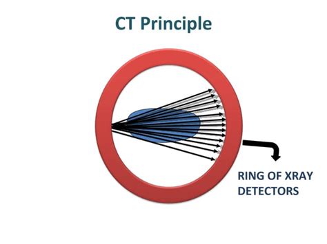 CT Scan Basics PPT