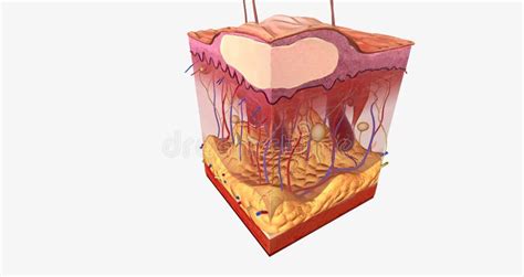 A Blister Is A Fluid Filled Raised Area On The Skin Caused By Too Much Friction In One Location