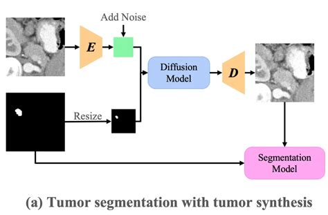 Optimizing Synthetic Data For Enhanced Pancreatic Tumor Segmentation Bagci Lab