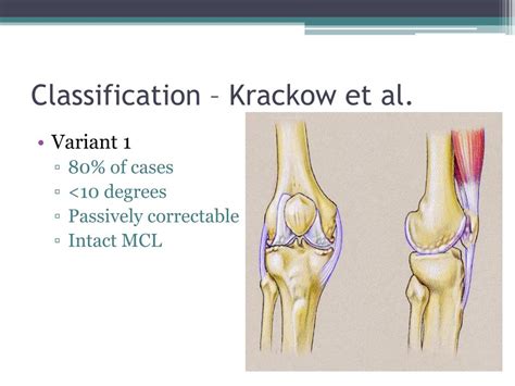 Ppt Tka In The Valgus Knee Powerpoint Presentation Free Download Id1873783