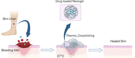 Preparation And Application Of Drug Loaded Nanogel Hybrid