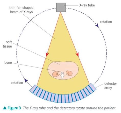 OCR Physics Module 6 Particles And Medical Physics Flashcards Quizlet