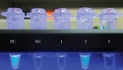 Visual Detection Of Lamp Products Under Uv Light The Combination Of Download Scientific