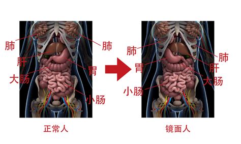 罕见江西一女子的内脏全长反了