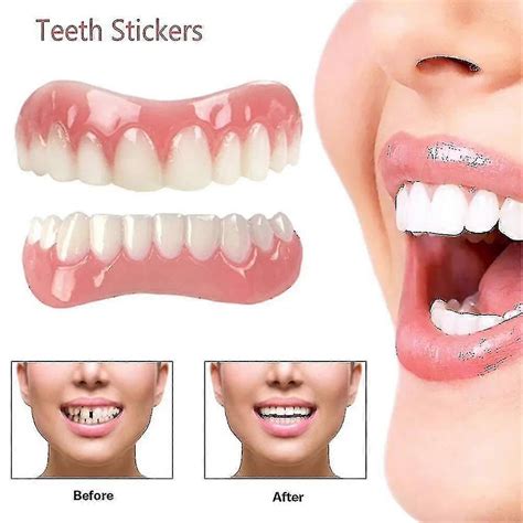 Extra Thin Fake Bright White Tooth Veneers Silicone Soft Safe Adhesive