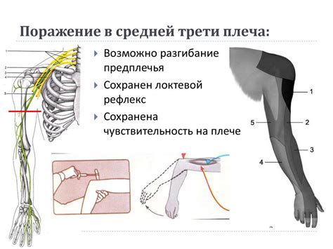 Семиотика поражений периферических нервов верхних конечностей - online ...