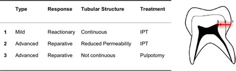 Dentin Response To Caries 1 In Noncavitated Enamel Caries Or Slowly Download Scientific