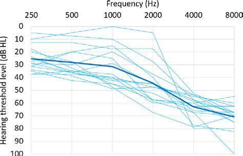 Figure 1 From Cross Modal Sensory Boosting To Improve High Frequency Hearing Loss Device
