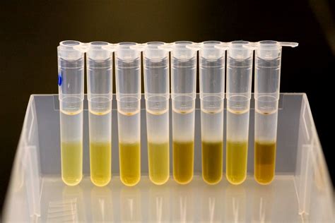 Dna Isolation 4 Free Photos On