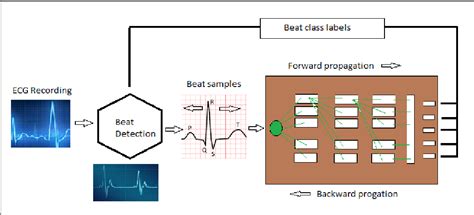 figure 1 from an automated ecg beat classification system using