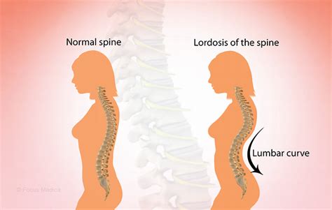 Health Condition Symptoms Causes Treatment And More