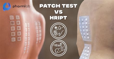 João Líbano Marques On Linkedin Hript Vs Patch Test What Are The
