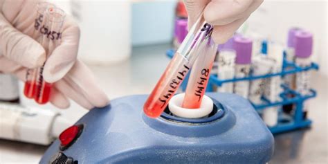 Optimizing Flow Cytometry Advantages Of Custom Cocktails And