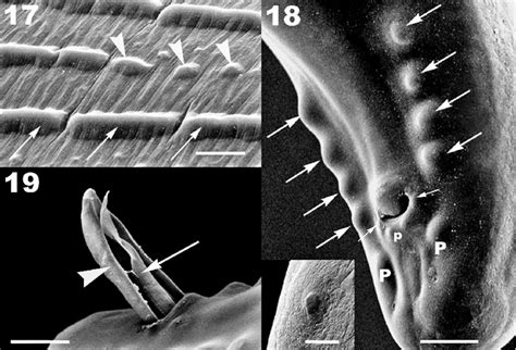 Morfologia Da Dirofilaria Immitis Nematodosis I Filariasis