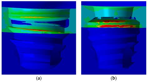 A Finite Element Analysis To Compare Stress Distribution On Extra Short Implants With Two