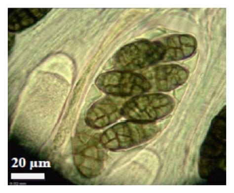 A Asci With Ascospores In K B Mature Ascospores Download