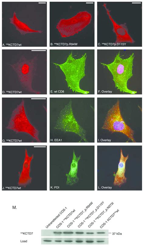 Intracellular Distribution And Expression Of Wild Type And Mutant Kctd7
