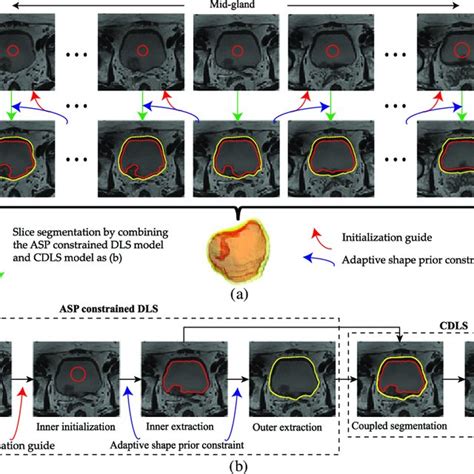 Some Challenges Of Bladder Wall Segmentation In Mr Images A Inside Download Scientific
