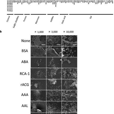 Binding Of Biotinylated Lectins To Human Saliva Components Binding Download Scientific Diagram