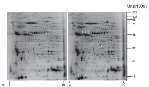 Sypro Ruby Stained 2de Gels Ph Range 3 10 From The Conditioned Medium Download Scientific