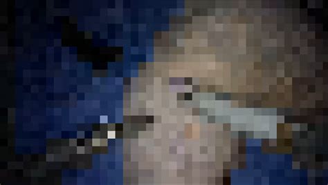 A New Player In Robotic Surgery Hugo Ras From Medtronic Head And