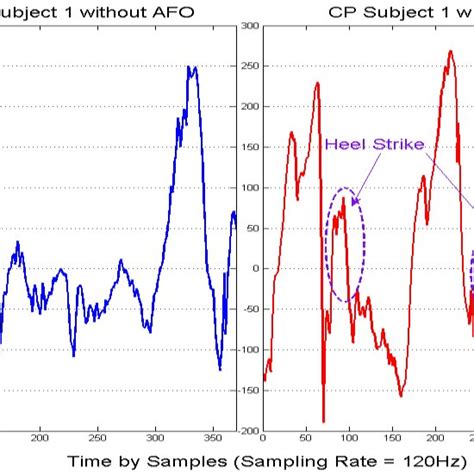 Shank Angular Velocity Of Cp Gait Without And With Afo The Afo Helps