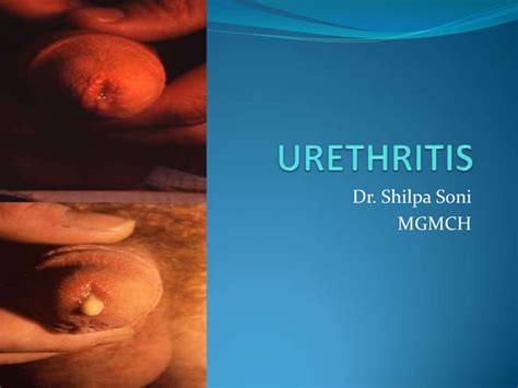 Sexually Transmitted Infections Stis Presented By Theresa Lowry