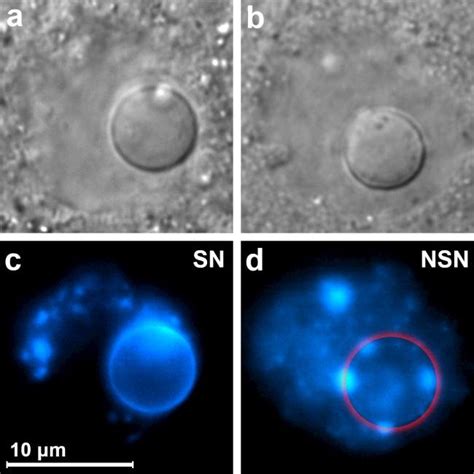 Main Oocyte Types Classified According To Chromatin Configuration After Download Scientific