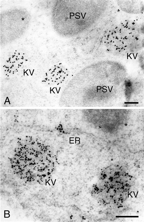 Electron Photographs Showing That Kv Was Immunogold Labeled With Download Scientific Diagram