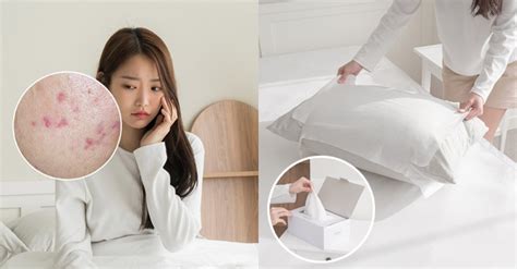 여드름 모낭염 두피염 피부 문제 예방하는 일회용 베개 커버 위키트리