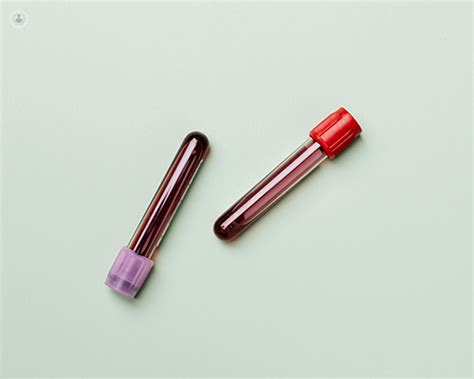 Eritropoyetina qué es síntomas y tratamiento Top Doctors