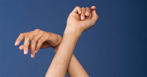 Gender Confirmation Surgery Transgender Mental Health