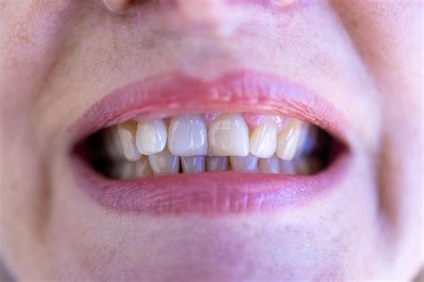 이 입 얼굴 Pixabay의 무료 사진