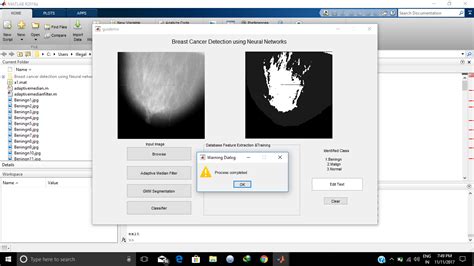 alternatives and detailed information of detection of breast cancer using neural networks
