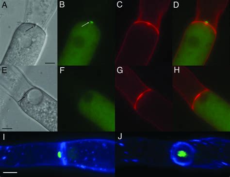 So A Protein Involved In Hyphal Fusion In Neurospora Crassa Localizes