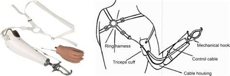 Designing A Prosthetic Arm Article By A Tutor
