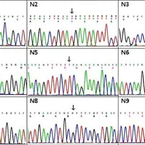 Automated Dna Sequencing Electropherogram Arrows Indicate The Automated Dna Sequencing Electropherogram Arrows Indicate The