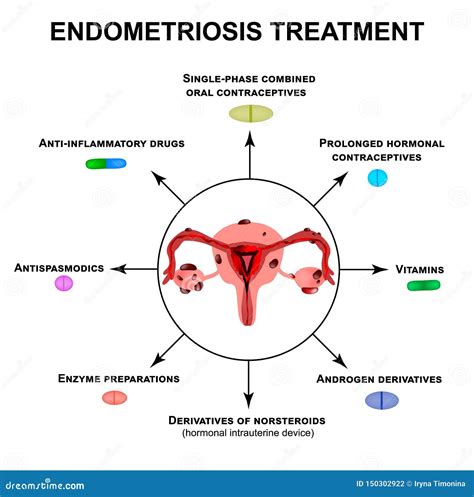 Endometriosis The Structure Of The Pelvic Organs Adenomyosis The Endometrium Vector