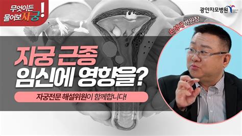 임신을 계획 하신다면 당장 시청하셔야 합니다 자궁근종 편 Youtube