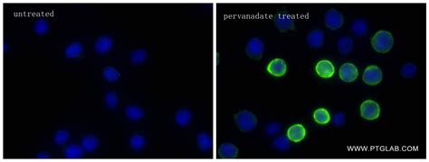 Phospho Syk Tyr323 Antibody 83331 1 Pbs Proteintech