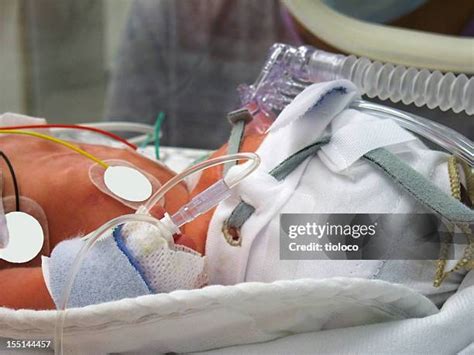 Icu Feeding Tube Photos And Premium High Res Pictures Getty Images