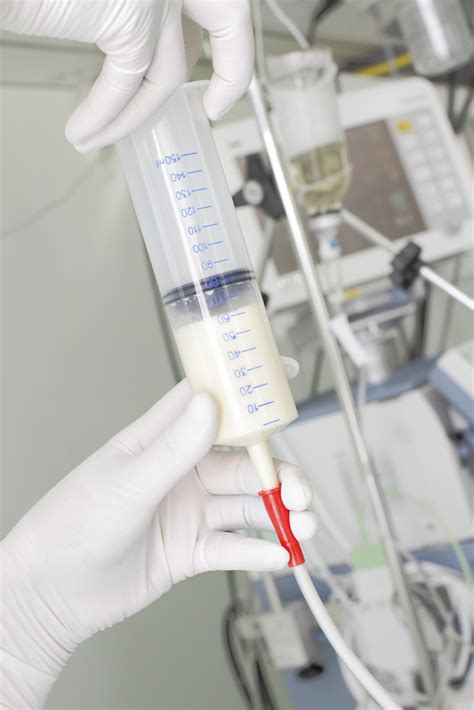 Who Invented The Feeding Tube At Mary Smithey Blog