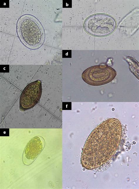 Huevo De Parásito En Heces