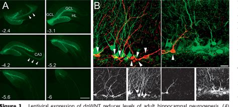 Figure 1 From Spatial And Object Recognition Memory In Adult Rats