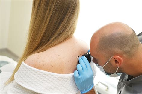 Skin Cancer Dermatologist Syracuse Highly Effective Removal Treatment