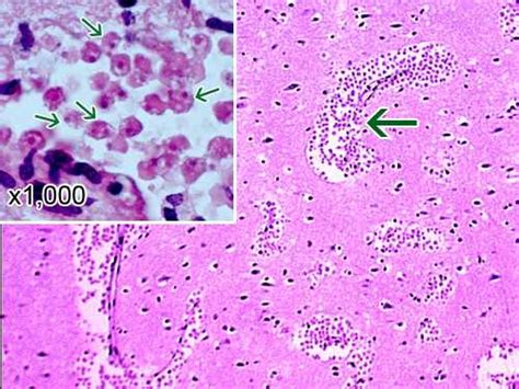 Photos Of Naegleria Fowleri Naegleria Fowleri Cdc